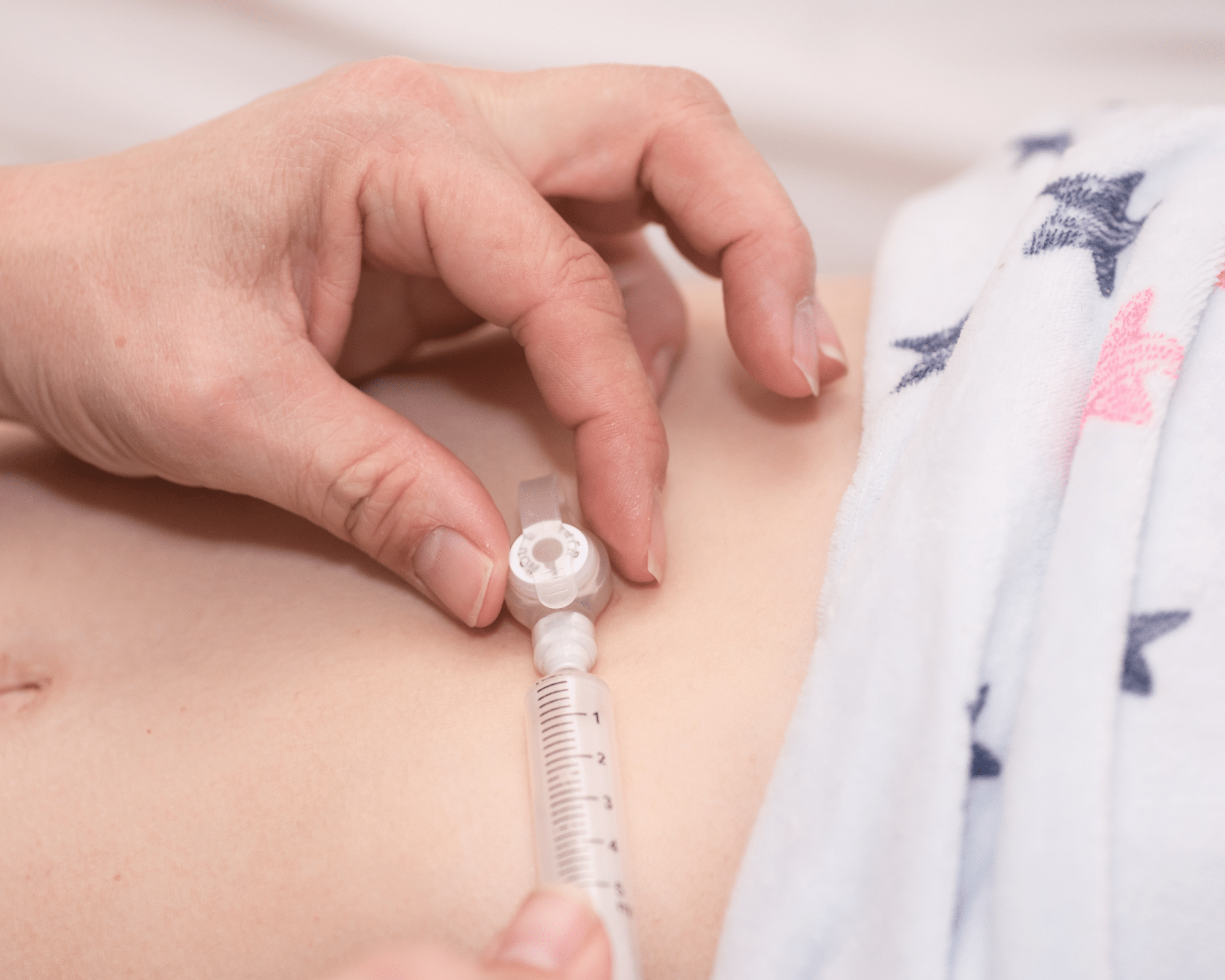 Qu’est-ce que la nutrition entérale ? - Hoist-Medical